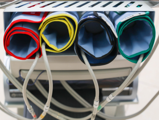 Ankle Brachial Index (ABI) – North West Hospital Cardiology